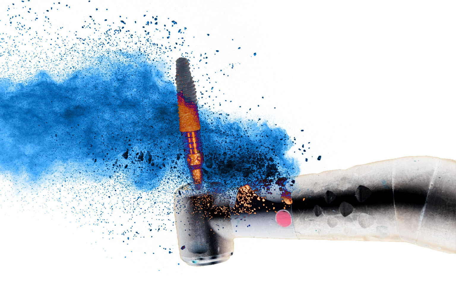 The Piriform Rim: Pearls & Pitfalls - AOX Surgery